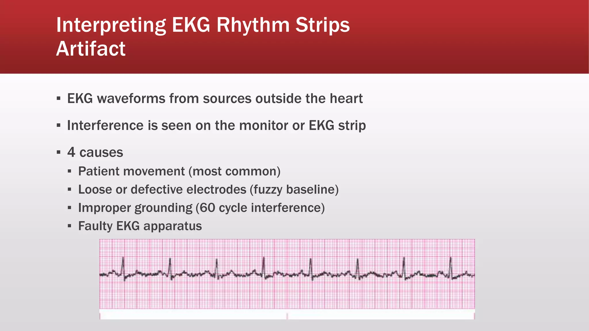 Basic-EKG-Refresher.pdf