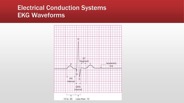 Basic-EKG-Refresher.pdf