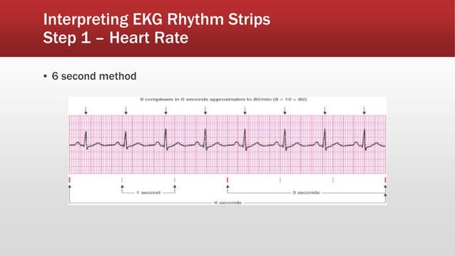 Basic-EKG-Refresher.pdf