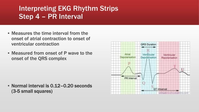 Basic-EKG-Refresher.pdf