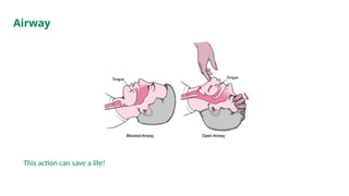 Basic-First-Aid-Cardiopulmonary-Resuscitation | PPT