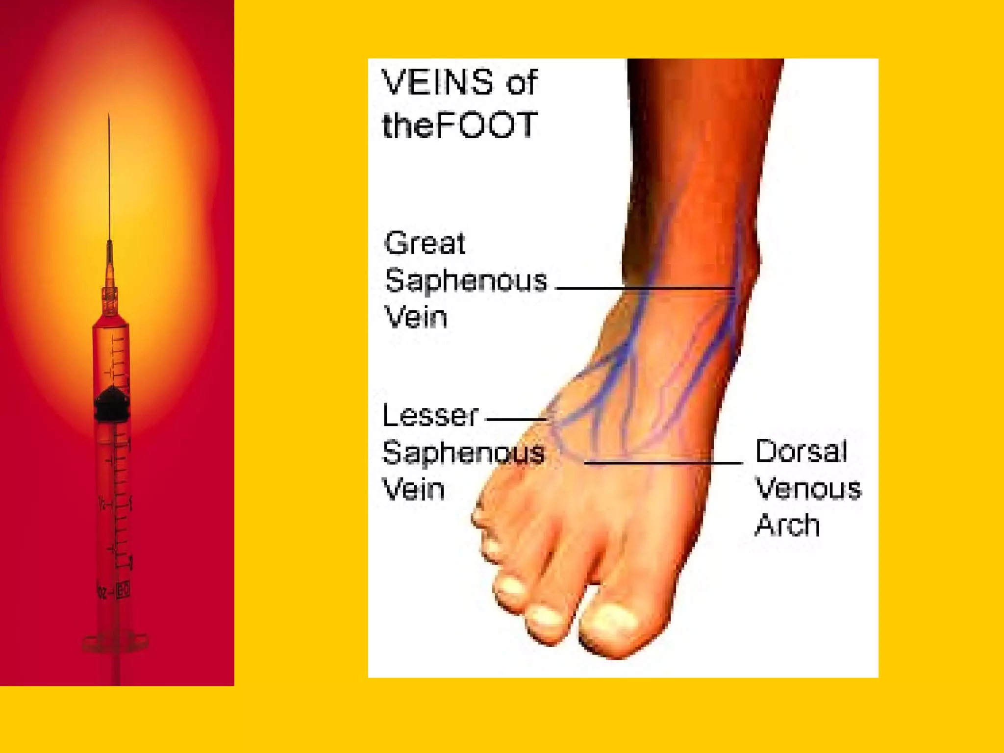 Basic Intravenous Therapy 1: Anatomy | PPT