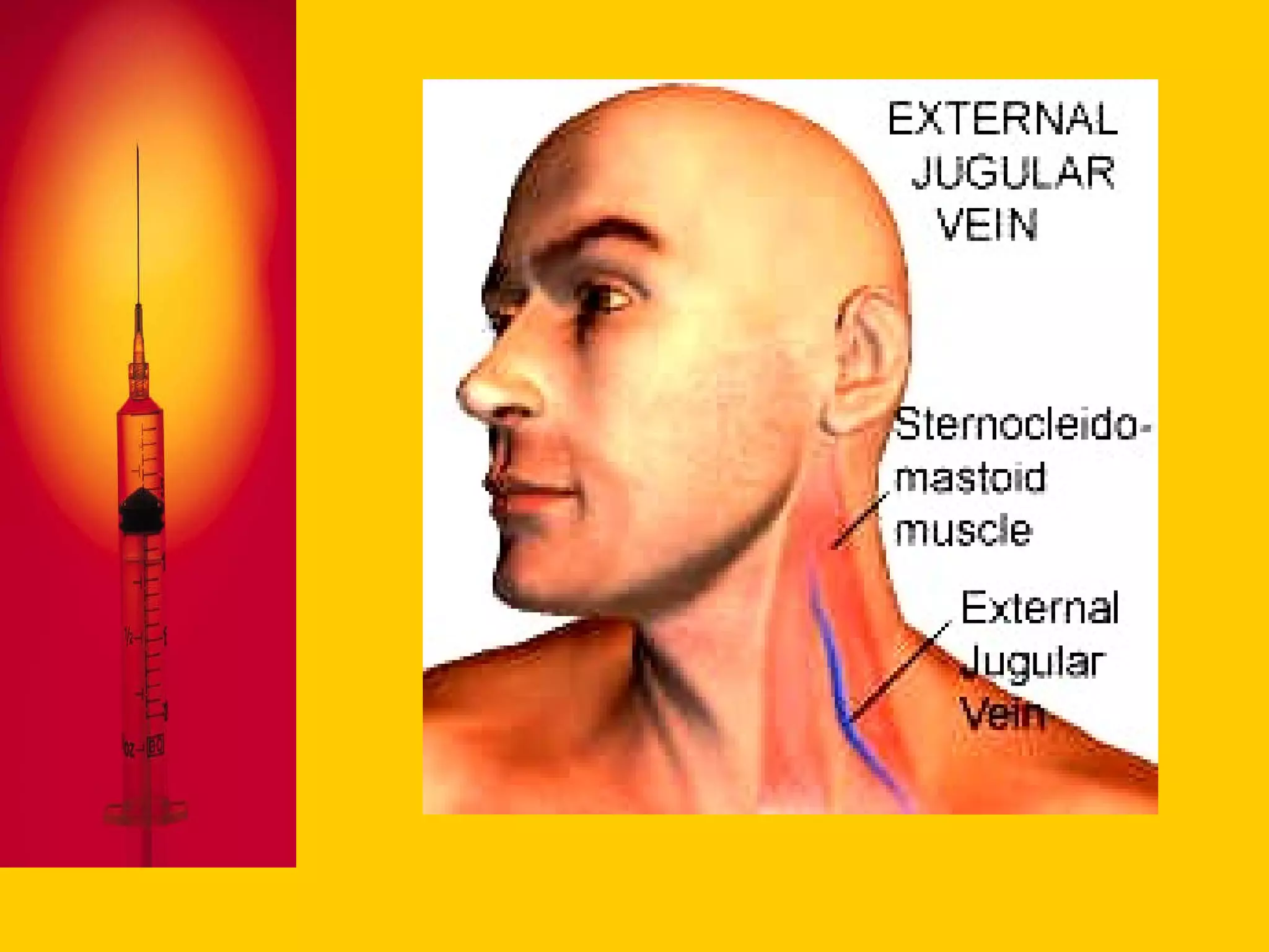 Basic Intravenous Therapy 1: Anatomy | PPT