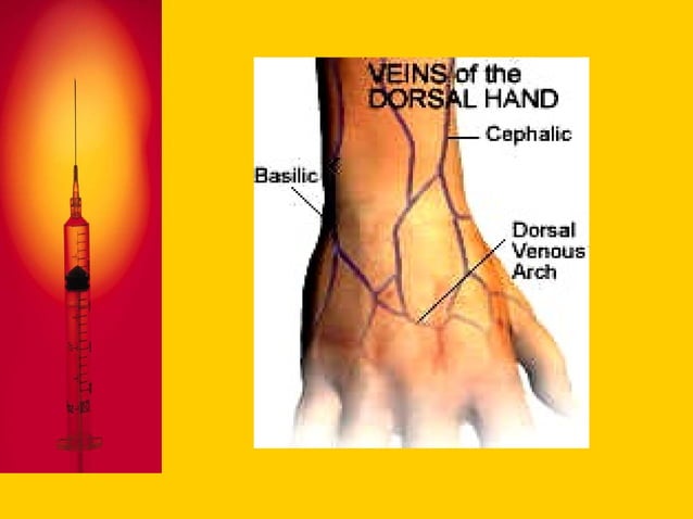 Basic Intravenous Therapy 1: Anatomy | PPT