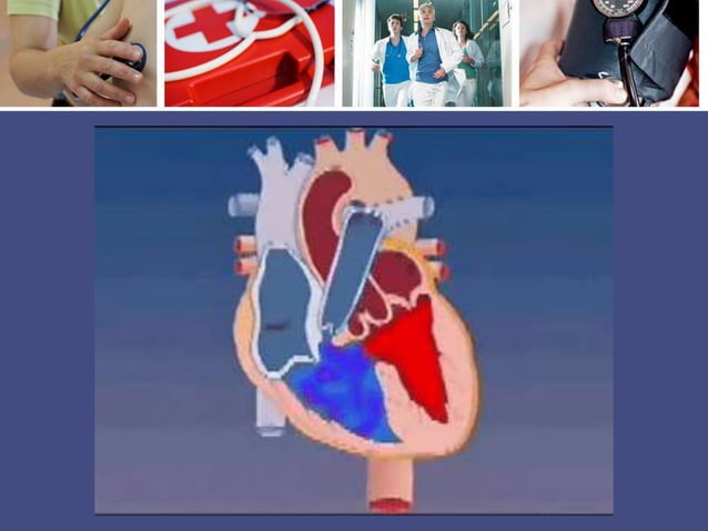 Basic Life Support Training Pptx