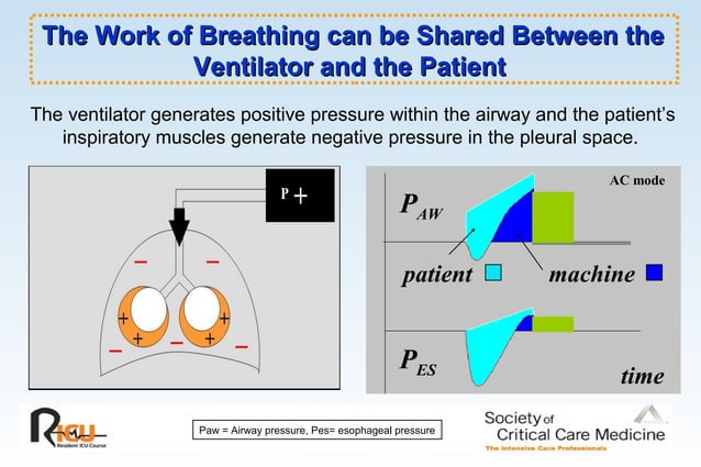Basic mechanical-ventilation | PPT