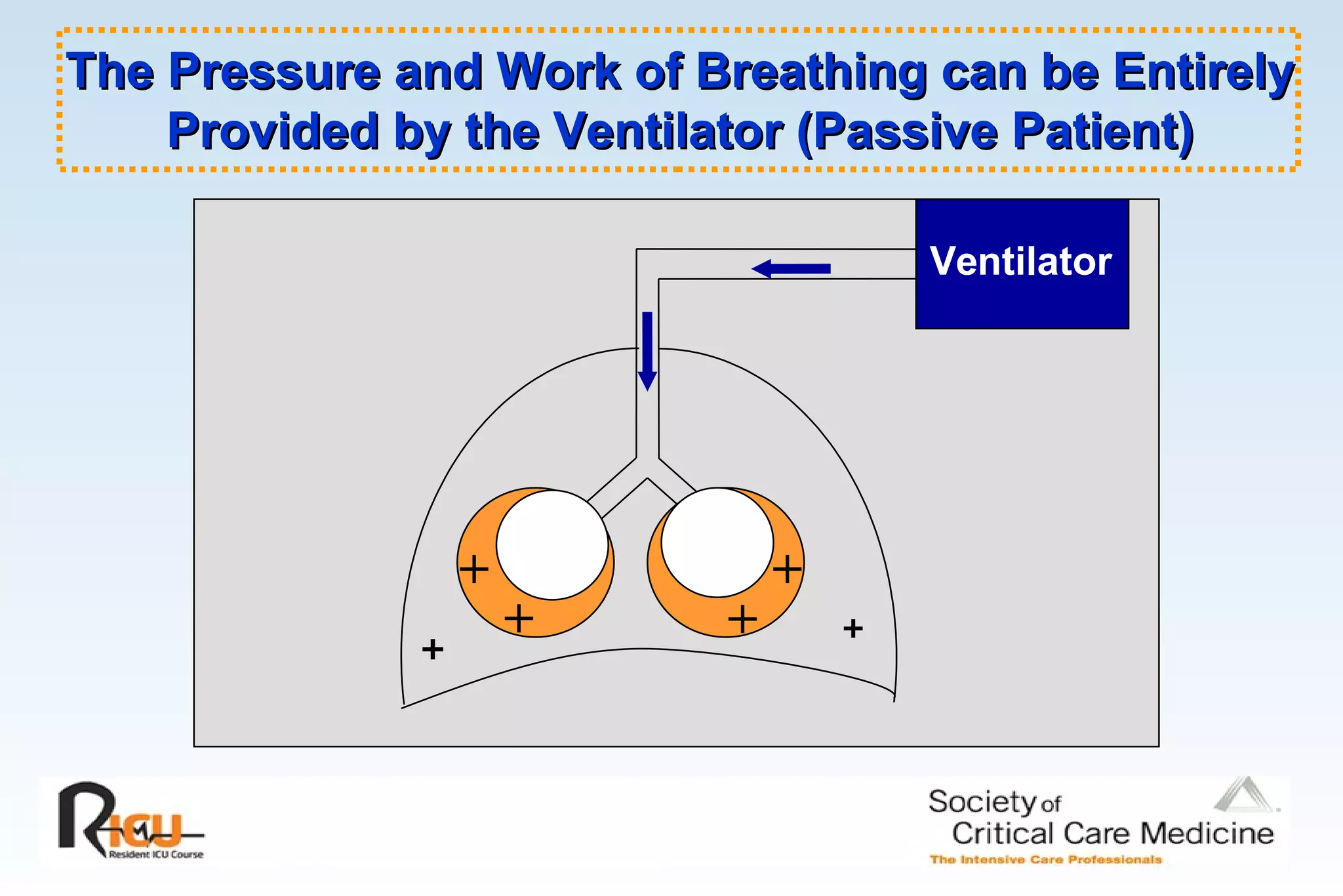 Basic Mechanical Ventilation | PPT