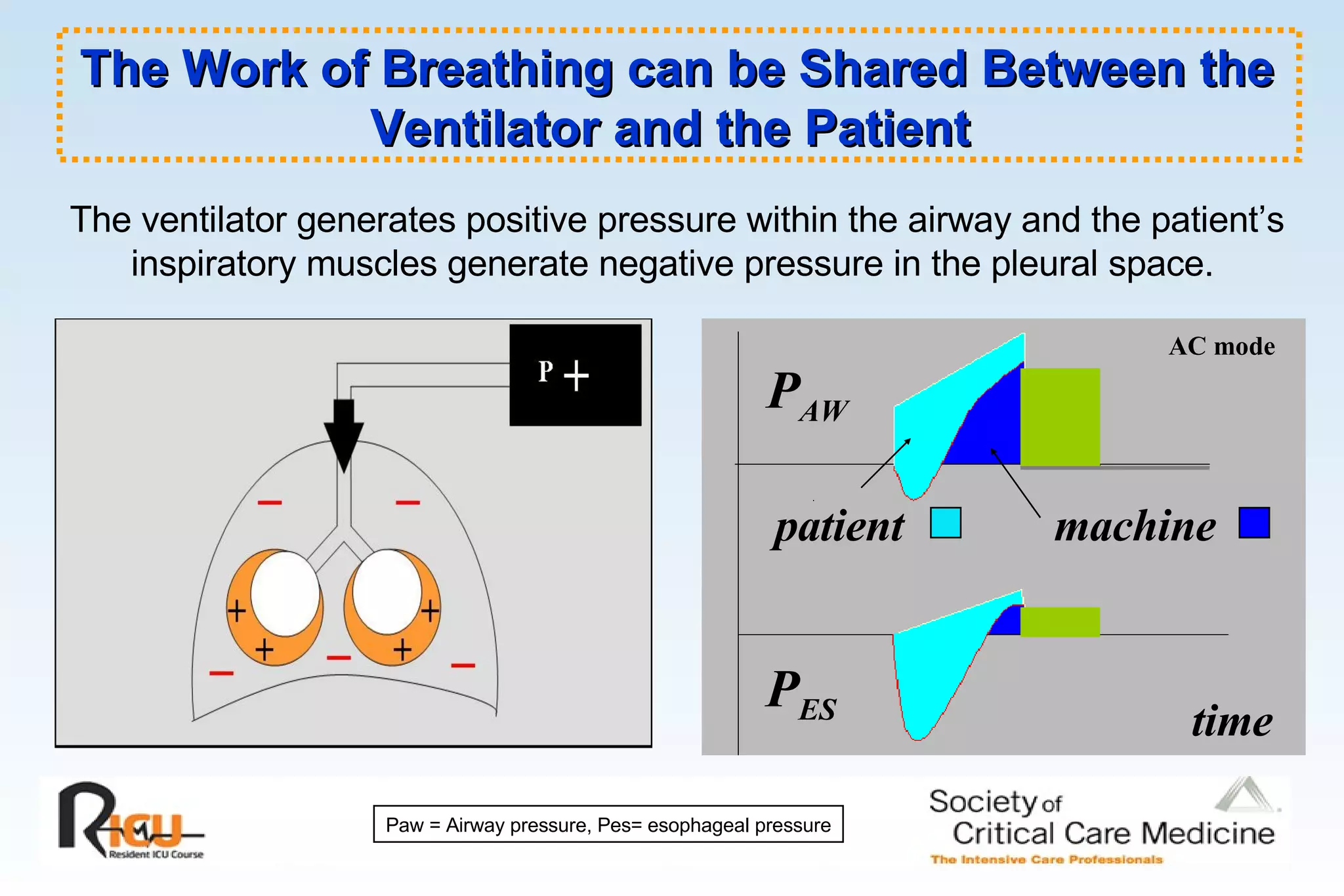 Basic Mechanical Ventilation | PPT