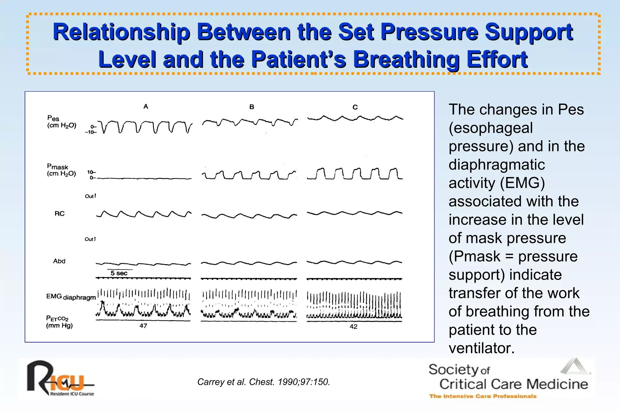Basic Mechanical Ventilation | PPT