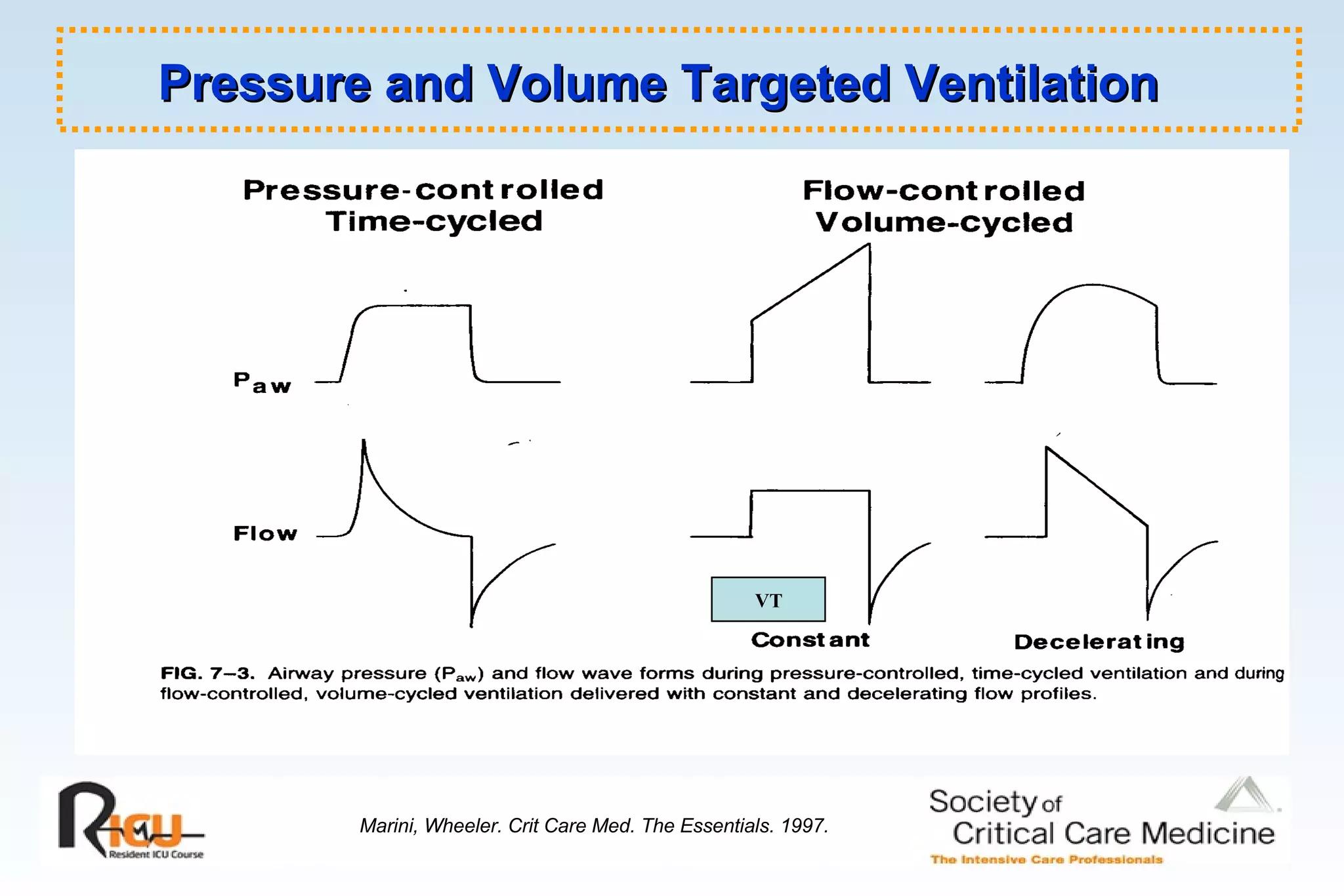Basic Mechanical Ventilation | PPT