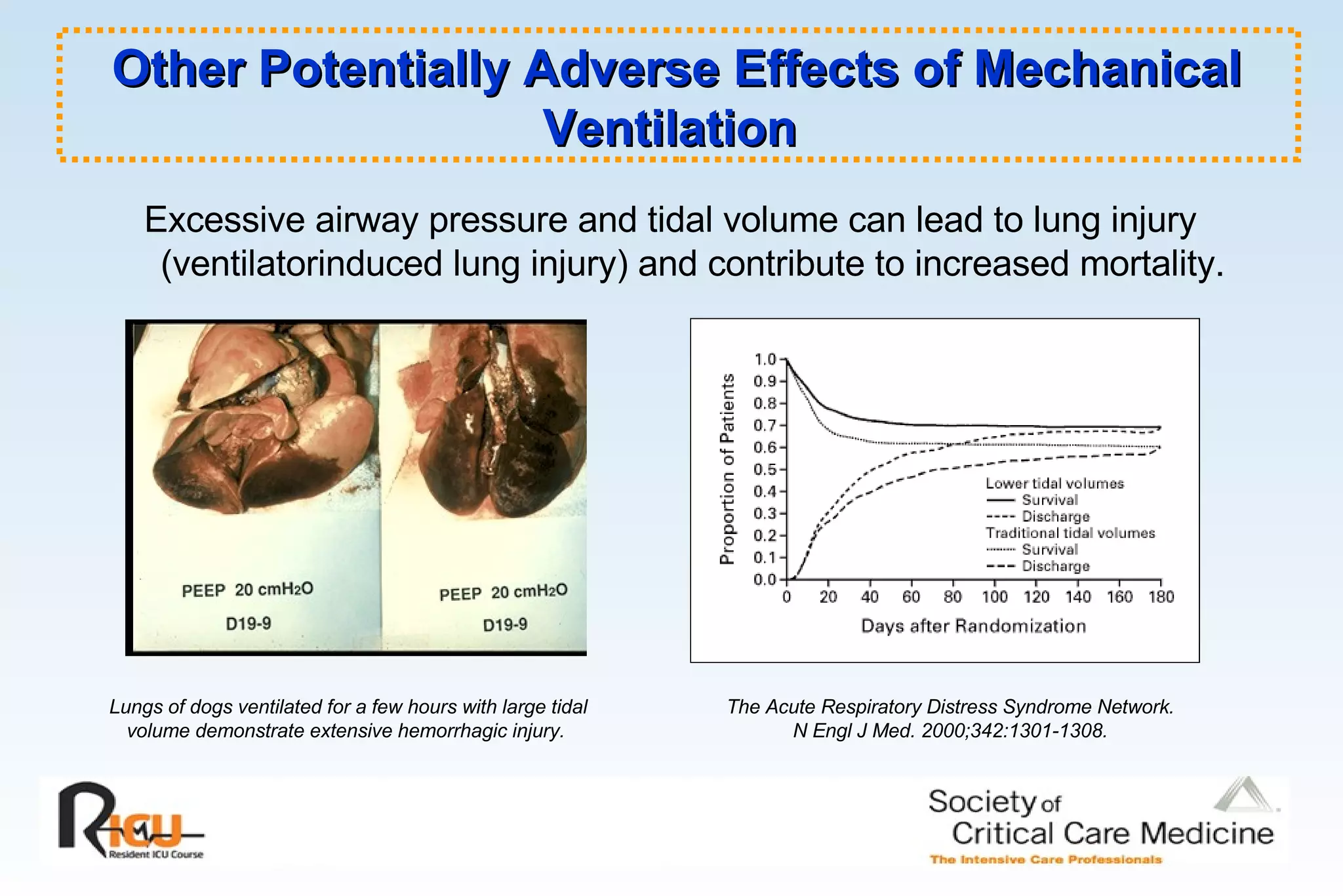 Basic Mechanical Ventilation | PPT