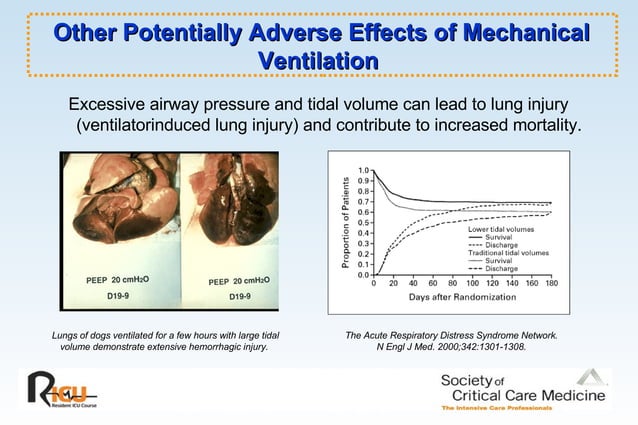 Basic Mechanical Ventilation | PPT