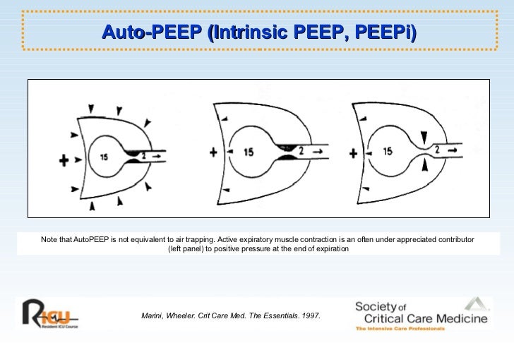 Basic Mechanical Ventilation