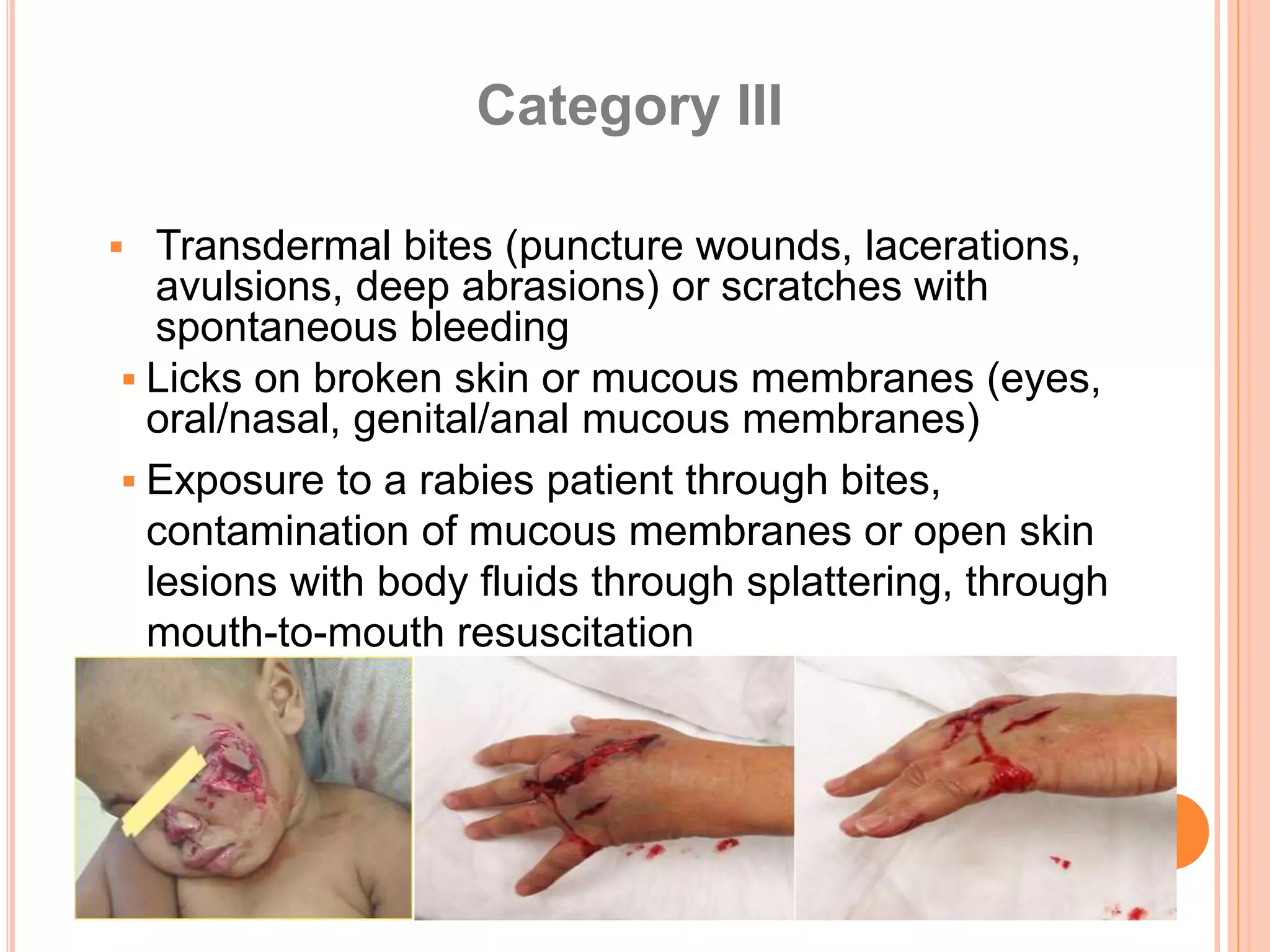 Basic rabies-for-dep ed | PPTX