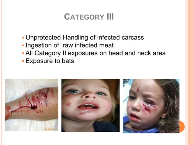 Basic rabies-for-dep ed | PPTX | Infectious Diseases | Diseases and ...