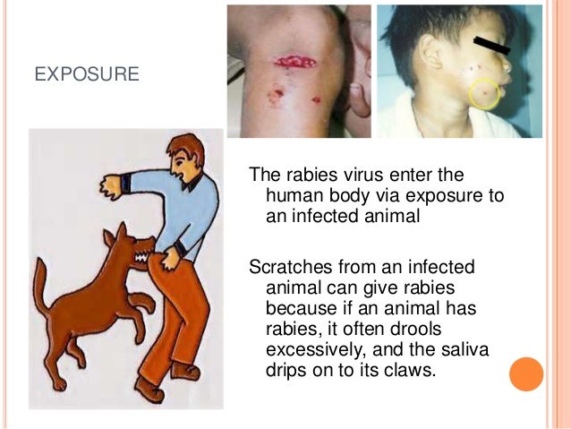 Basic rabies-for-dep ed