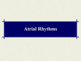 Basic Rhythm Strip Review | PPT