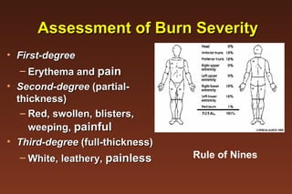 Basic Trauma And Burn Management | PPT