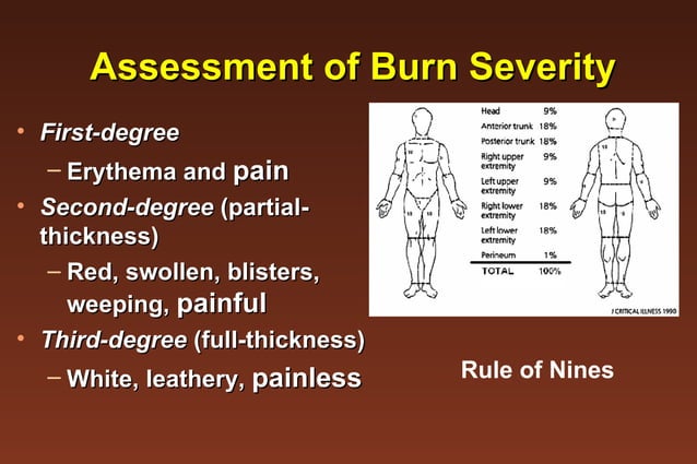 Basic Trauma And Burn Management | PPT
