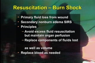 Basic Trauma And Burn Management | PPT