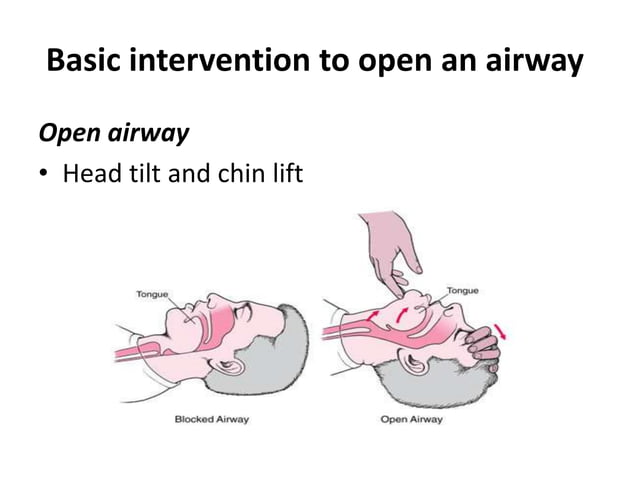 Basic Airway management.pptx | First Aid | Injuries