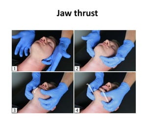 Basic Airway management.pptx