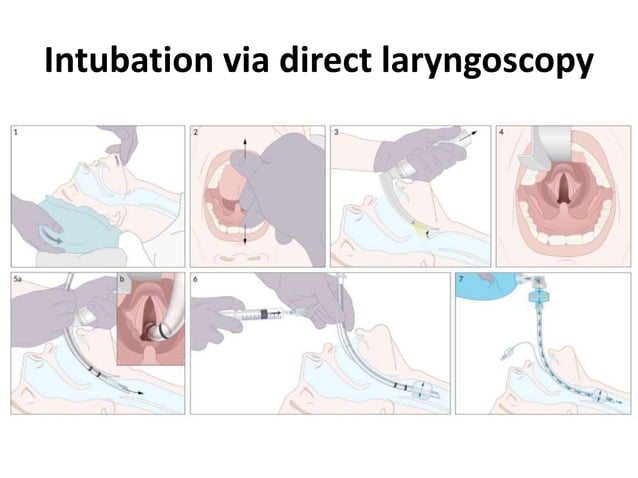 Basic Airway management.pptx | First Aid | Injuries