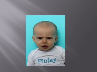 2013 Pediatric Fellows Boot Camp_Oxygen Delivery Devices | PPT