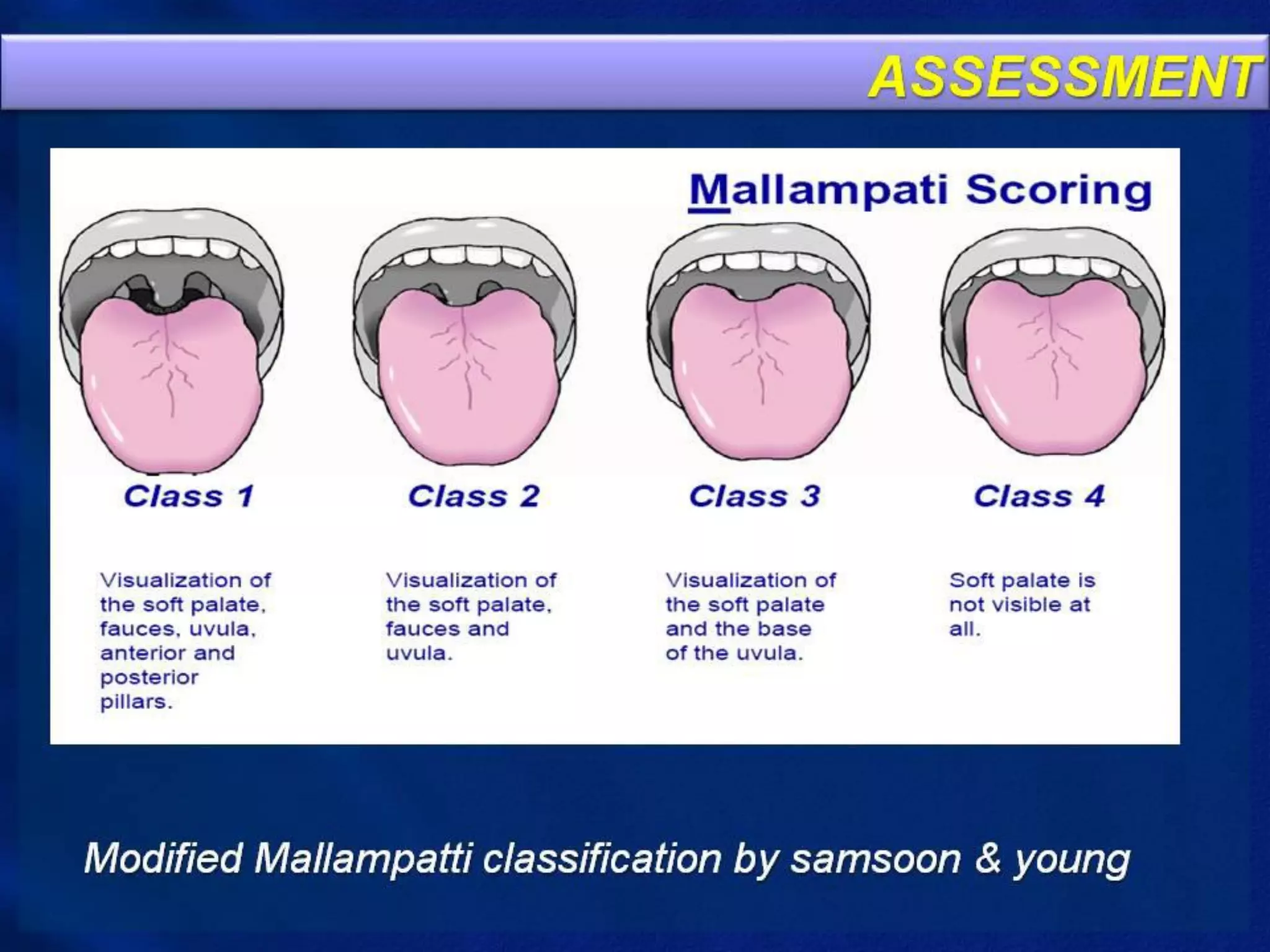 Basic airway management | PDF