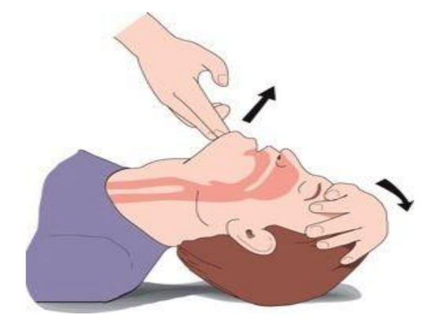 Basic airway management | PDF