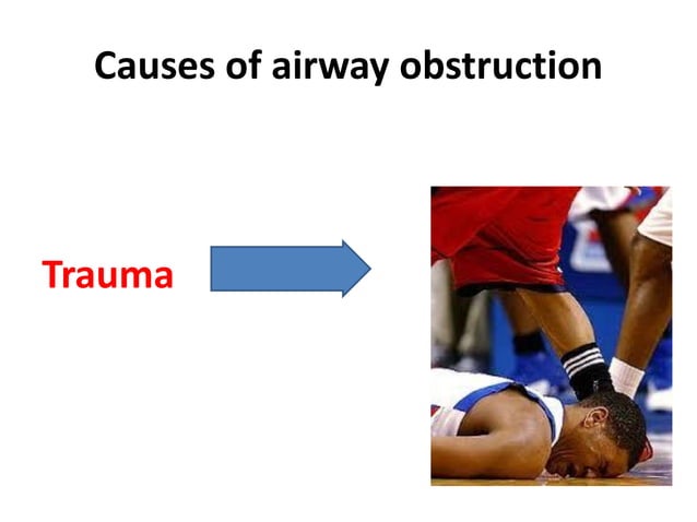 Basic airway management | PDF