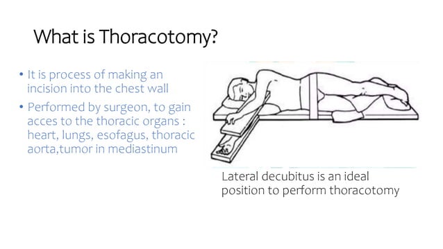 Basic Anatomi For Toracic Surgery 1 Pptx