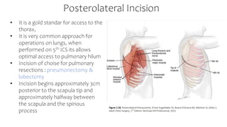 basic anatomi for toracic surgery 1.pptx