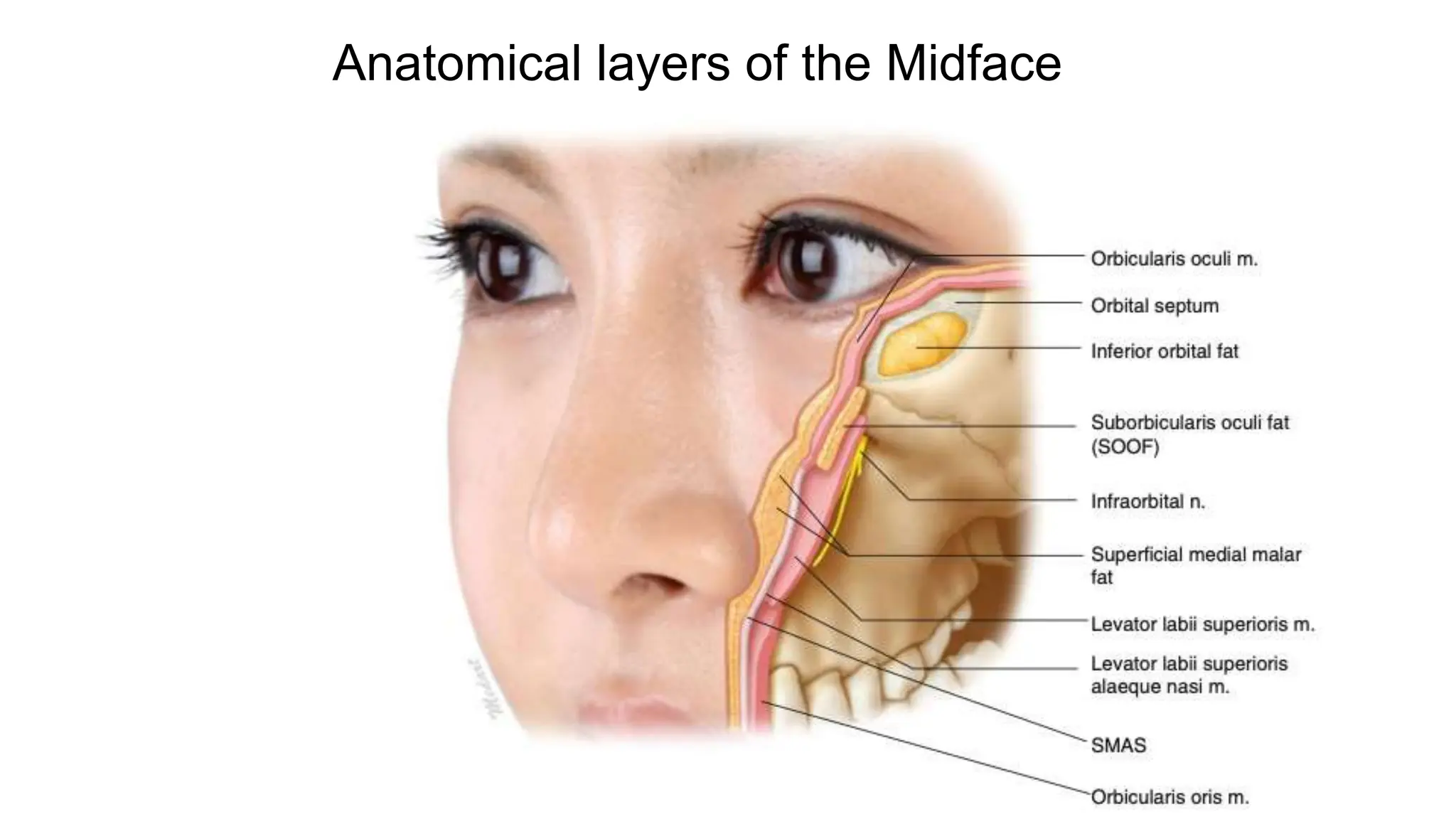 Basic Anatomy of the tear trough area .pptx