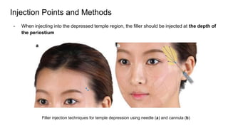 Basic Anatomy of the tear trough area .pptx