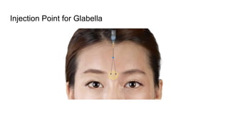 Basic Anatomy of the tear trough area .pptx