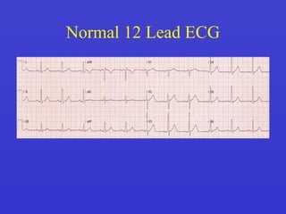 Cardio Vascular Anatomy & ECG | PPT