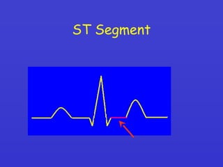 Cardio Vascular Anatomy & ECG | PPT