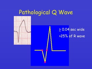 Cardio Vascular Anatomy & ECG | PPT