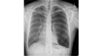Basic Anatomy of Chest X Ray.pptx