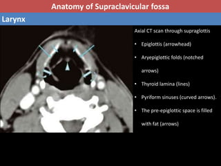 Basic anatomy & Radiology for breast cancer case | PPTX