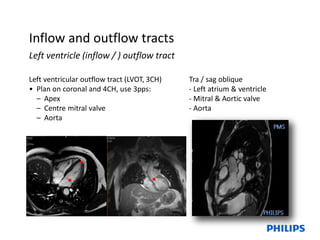 Basic and Advance Cardiac Planning.pdf