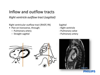 Basic and Advance Cardiac Planning.pdf