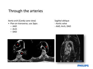 Basic and Advance Cardiac Planning.pdf
