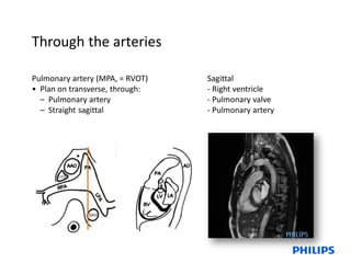 Basic and Advance Cardiac Planning.pdf