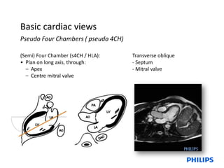 Basic and Advance Cardiac Planning.pdf
