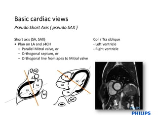Basic and Advance Cardiac Planning.pdf