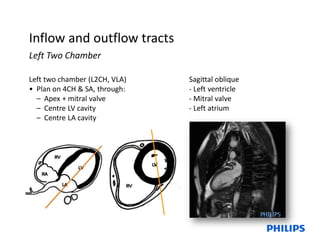 Basic and Advance Cardiac Planning.pdf