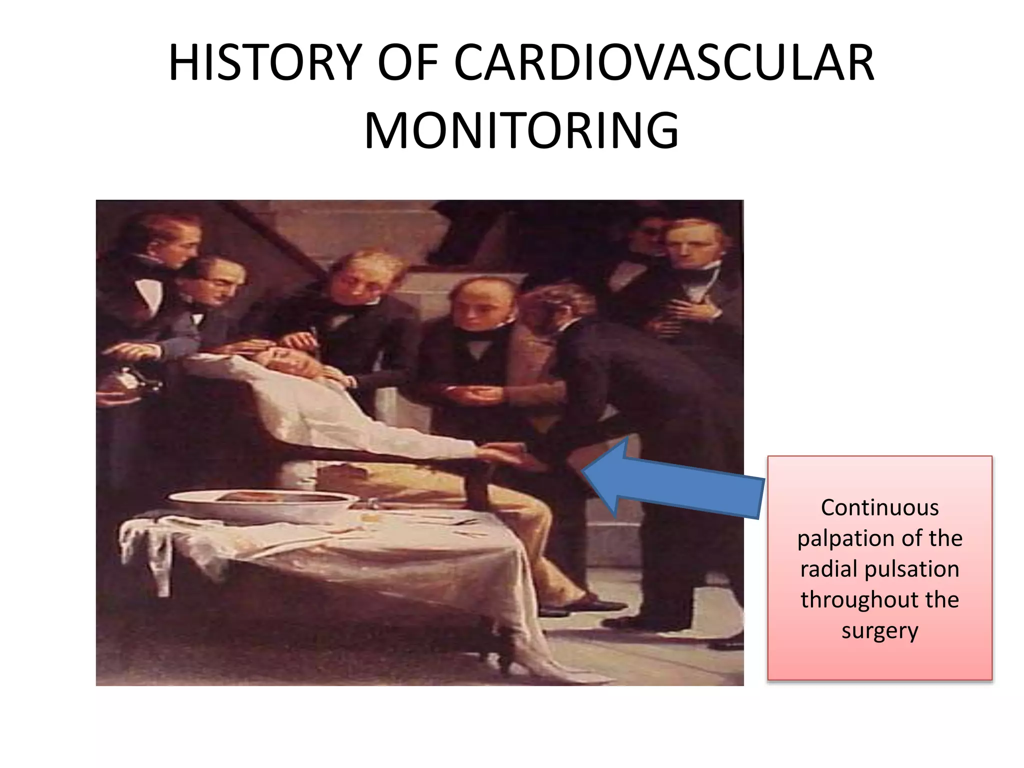 Basic and advanced Cardiovascular monitoring.pptx