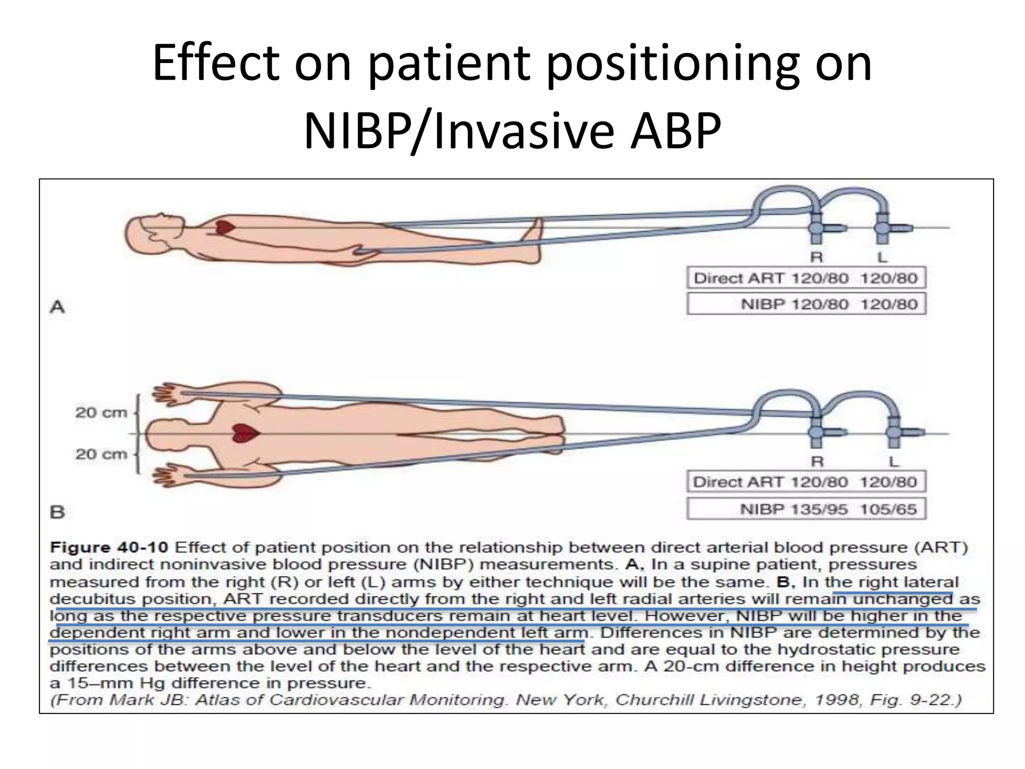 Basic and advanced Cardiovascular monitoring.pptx